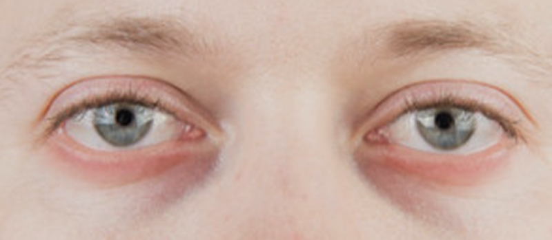 Pálpebras - Marcelo Golbert